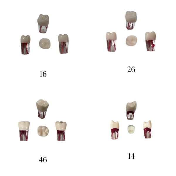 Pack of 5 Endo Teeth